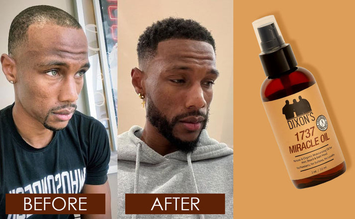 Hair Bundle – Dixon's 1737